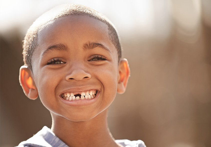 Dental trauma to baby/milk teeth – Online Dentist