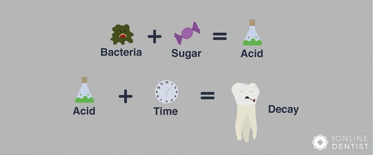 decay-chart – Online Dentist